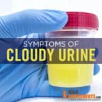 Cloudy Urine Symptoms, Causes and Treatment