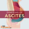 Ascites: Symptoms, Causes & Treatment