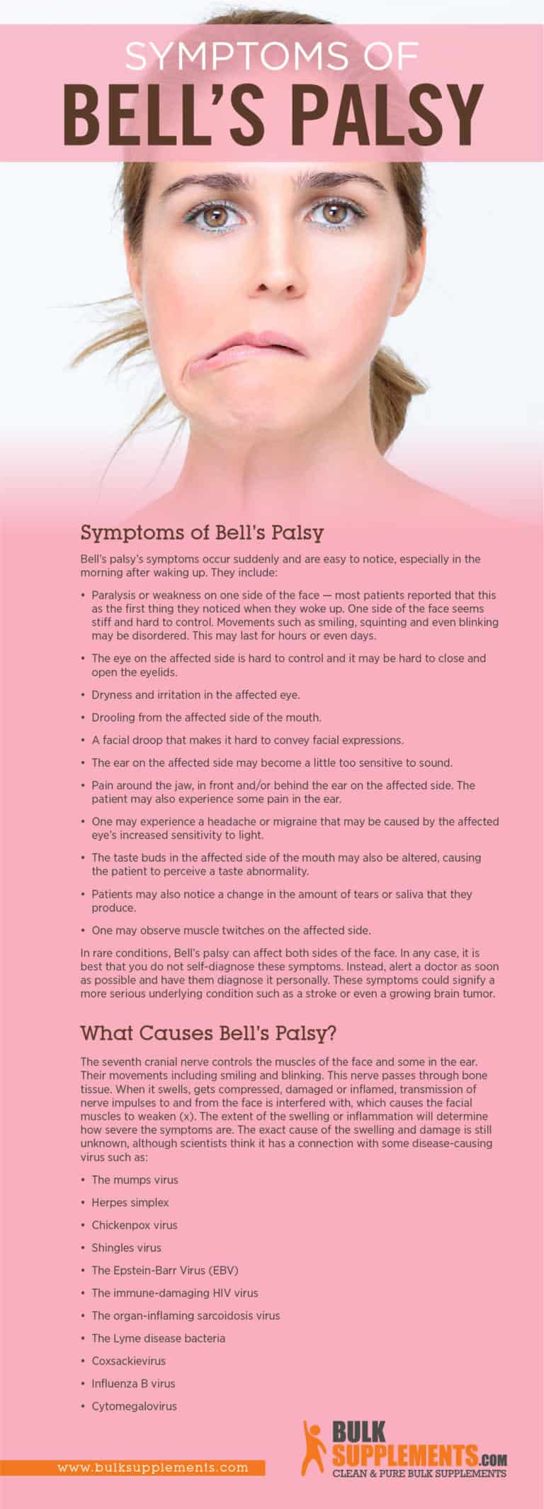 Bell's Palsy Symptoms, Causes & Treatment