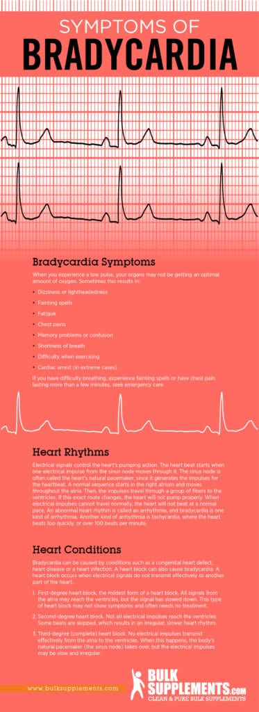 Bradycardia: Symptoms, Causes & Treatment