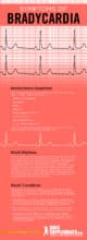 Bradycardia: Symptoms, Causes & Treatment