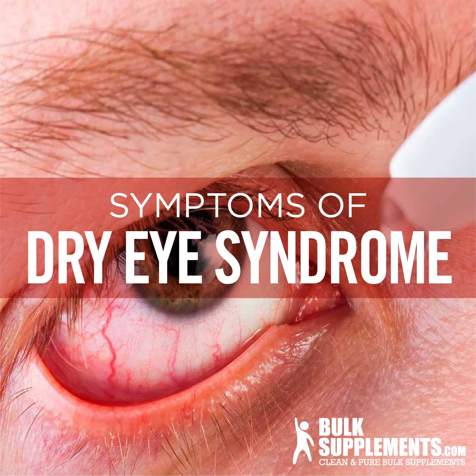 Dry Eye Syndrome Symptoms Causes Treatment Dry Eye Syndrome Symptoms Causes Treatment