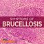 Brucellosis: Symptoms, Causes & Treatment