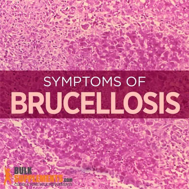 Brucellosis: Symptoms, Causes & Treatment
