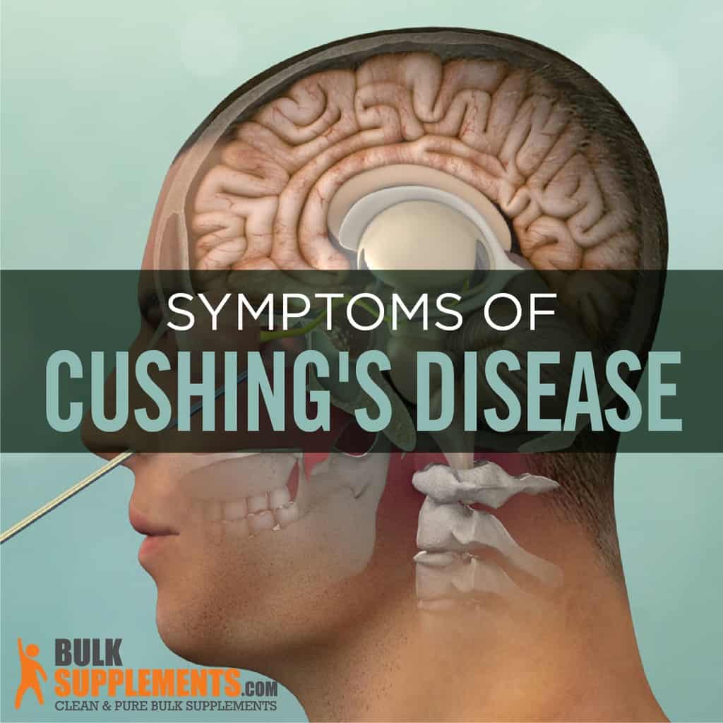 Cushing s Disease Symptoms Causes Treatment