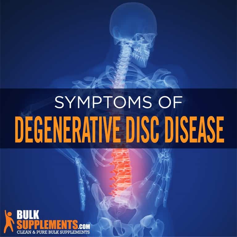 Degenerative Disc Disease: Symptoms, Causes & Treatment