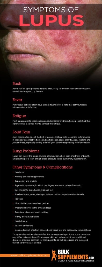 What is Lupus: Signs, Causes, Symptoms & Treatment