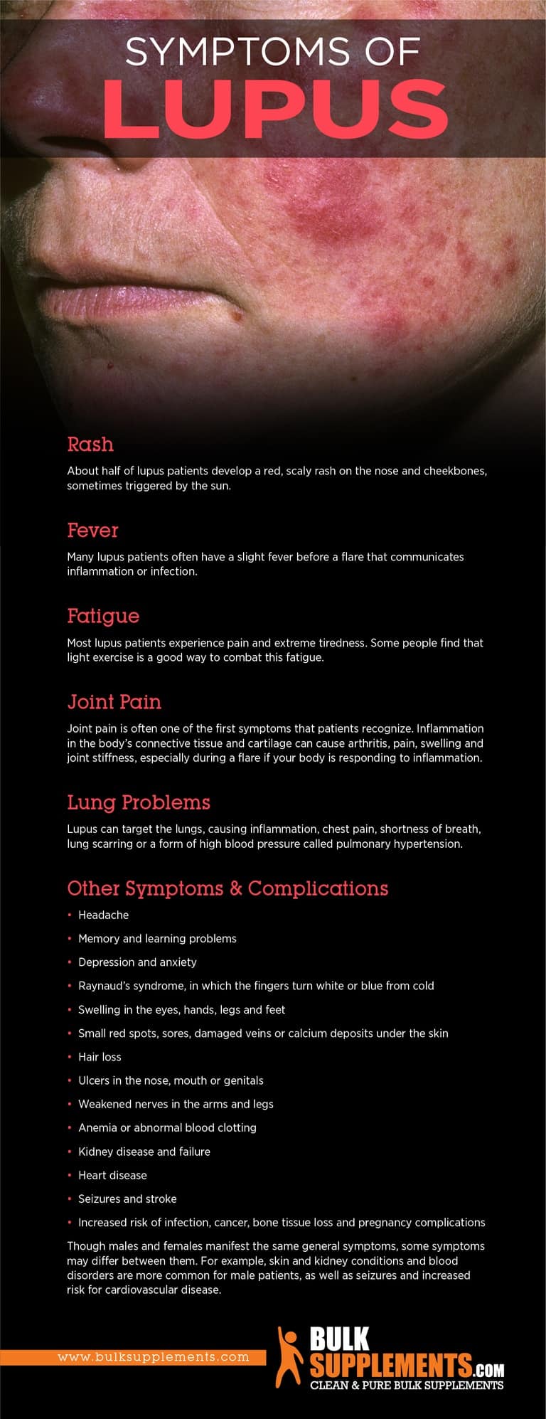 What is Lupus: Signs, Causes, Symptoms & Treatment