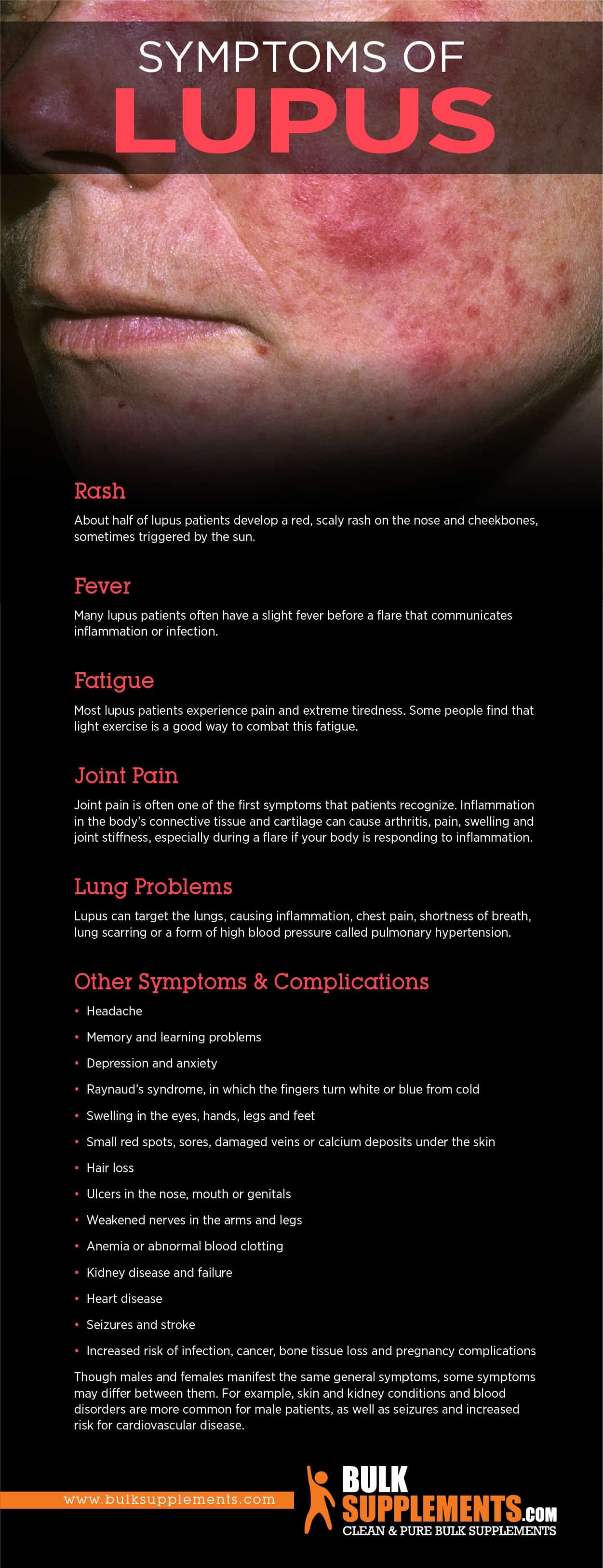 What Is Lupus Signs Causes Symptoms Treatment