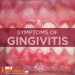 Gingivitis: Symptoms, Causes & Treatment