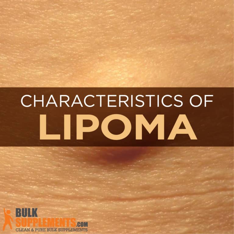 Lipoma: Characteristics, Causes & Treatment