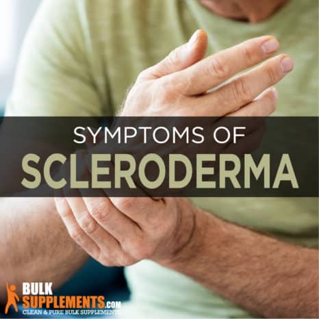 Scleroderma: Symptoms, Causes & Treatment