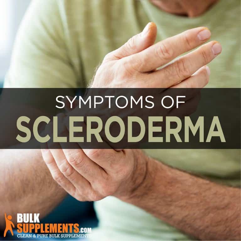Scleroderma: Symptoms, Causes & Treatment