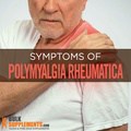 Polymyalgia Rheumatica: Symptoms, Causes & Treatment