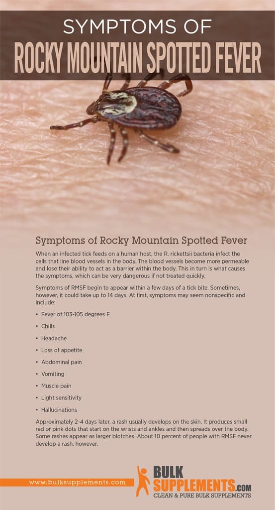 Rocky Mountain Spotted Fever: Causes, Symptoms & Treatment