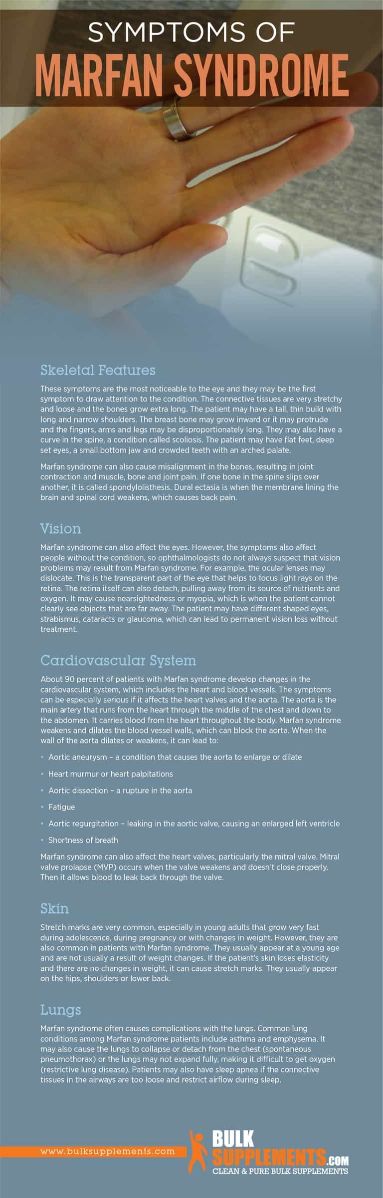 Marfan Syndrome: Understanding Causes, Symptoms, & Treatment