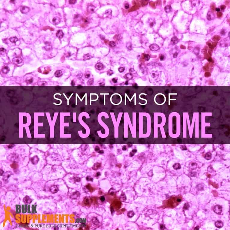 Reye's Syndrome. Boost Immunity. Vitamins & Minerals Supplements