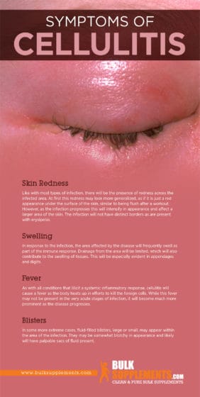 Cellulitis: Symptoms, Causes & Treatment