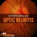 Optic Neuritis: Symptoms, Causes & Treatment