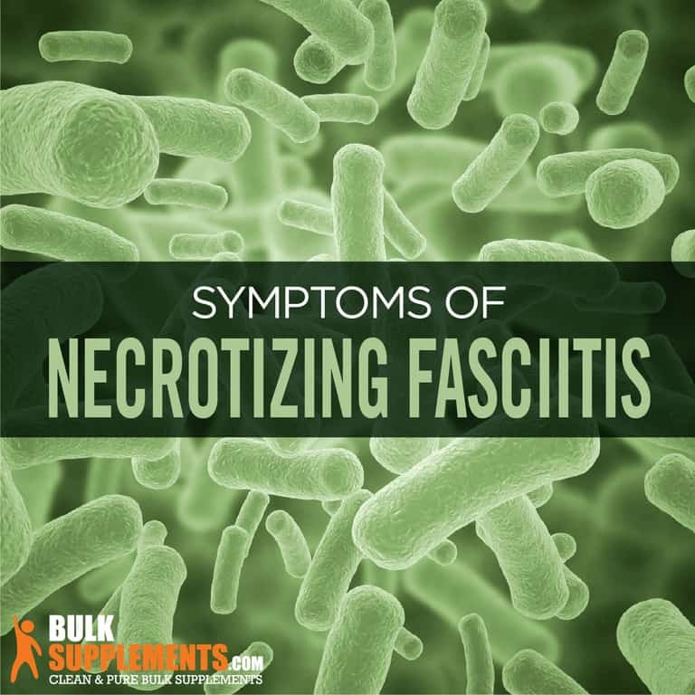Necrotizing Fasciitis: Symptoms, Causes & Treatment