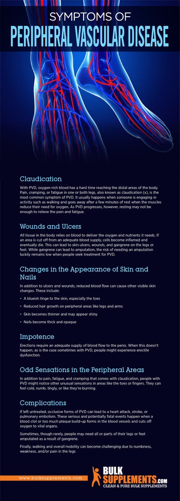 Peripheral Vascular Disease. Get Relief of Leg Pain with Our Supplements