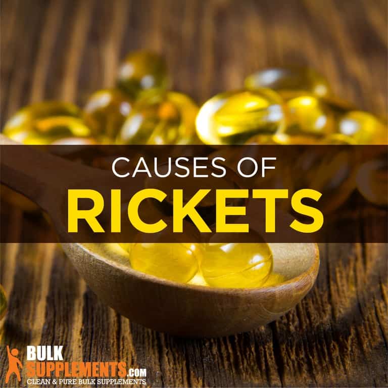 Rickets Causes, Symptoms & Treatment