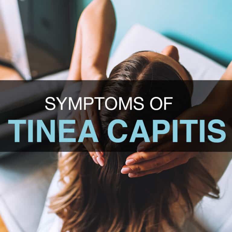 Tinea Capitis: Symptoms, Causes, Treatment & Tinea Capitis Supplements